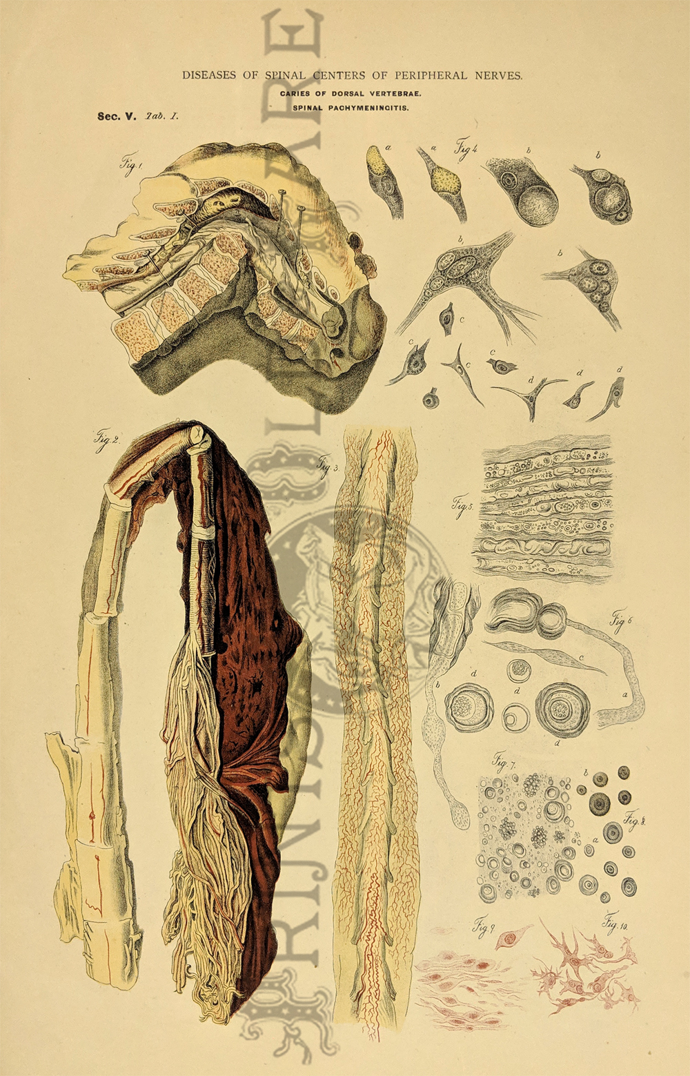 Prints Old & Rare - Medical, Surgical and Anatomy - Antique Maps & Prints